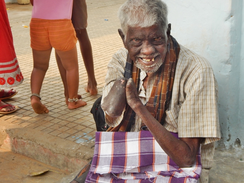 Helping the Lepers of India - Covenant Messenger Ministries